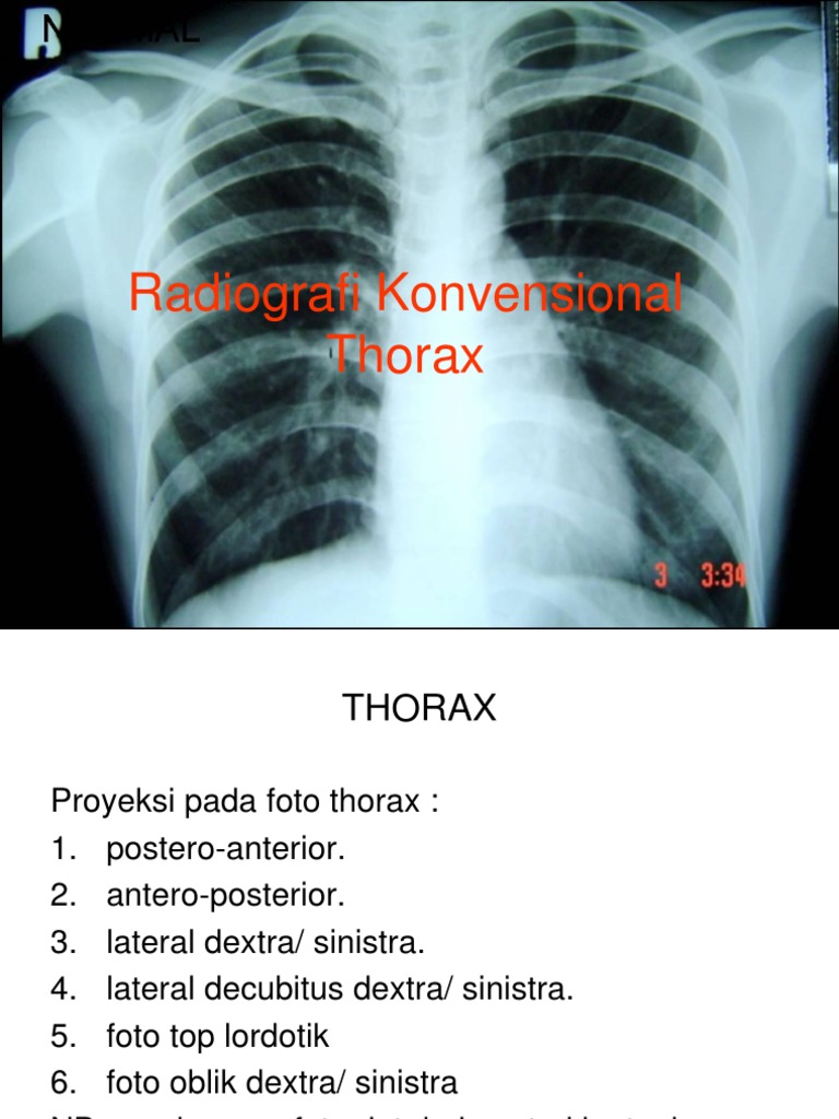 Slide Radiologi | PDF