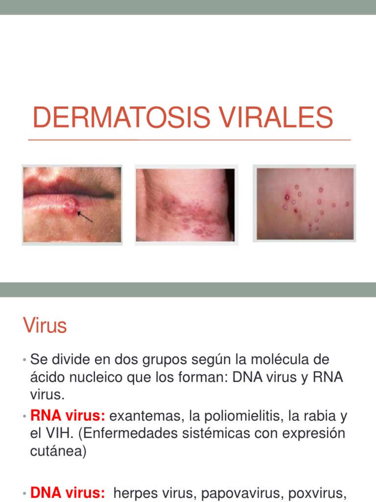 Dermatosis Virales | PDF | Herpes Simple | Virus