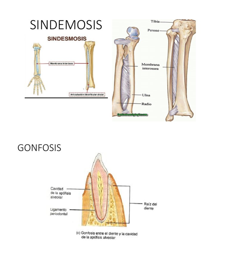 Sindesmosis | PDF