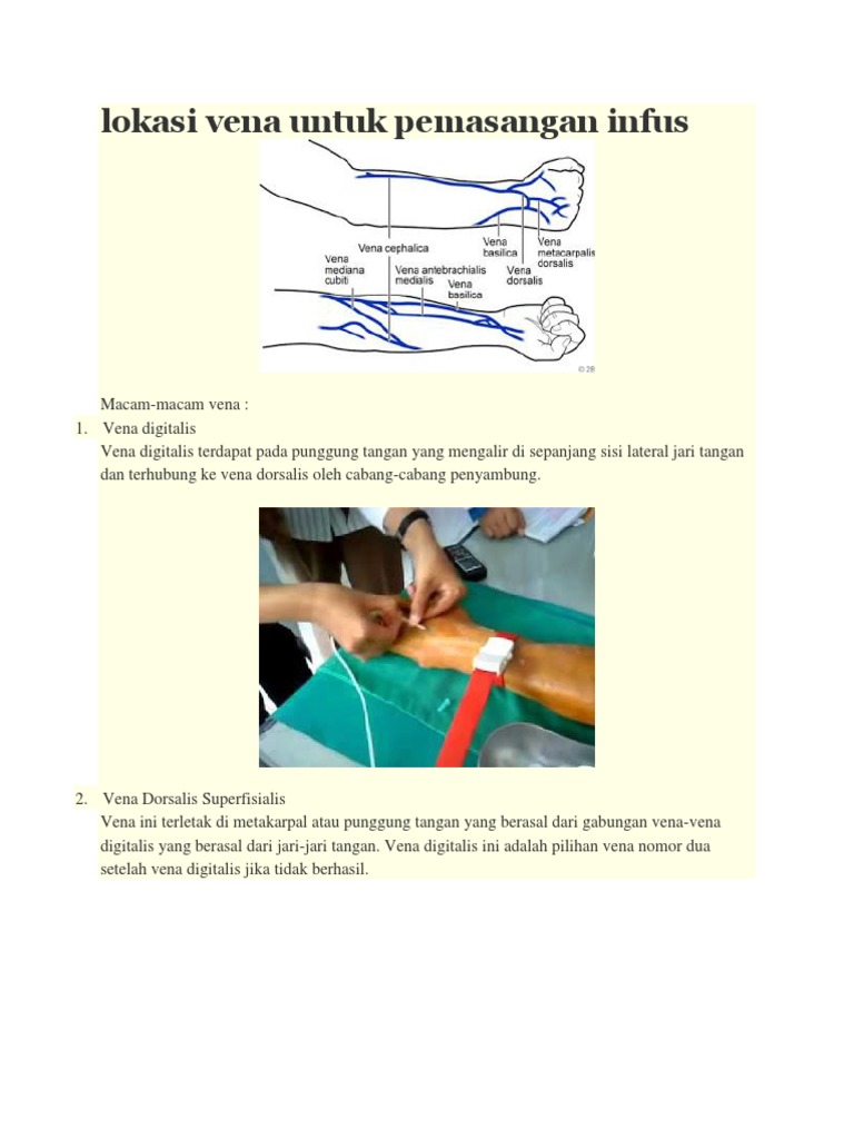 Lokasi Vena Untuk Pemasangan Infus | PDF
