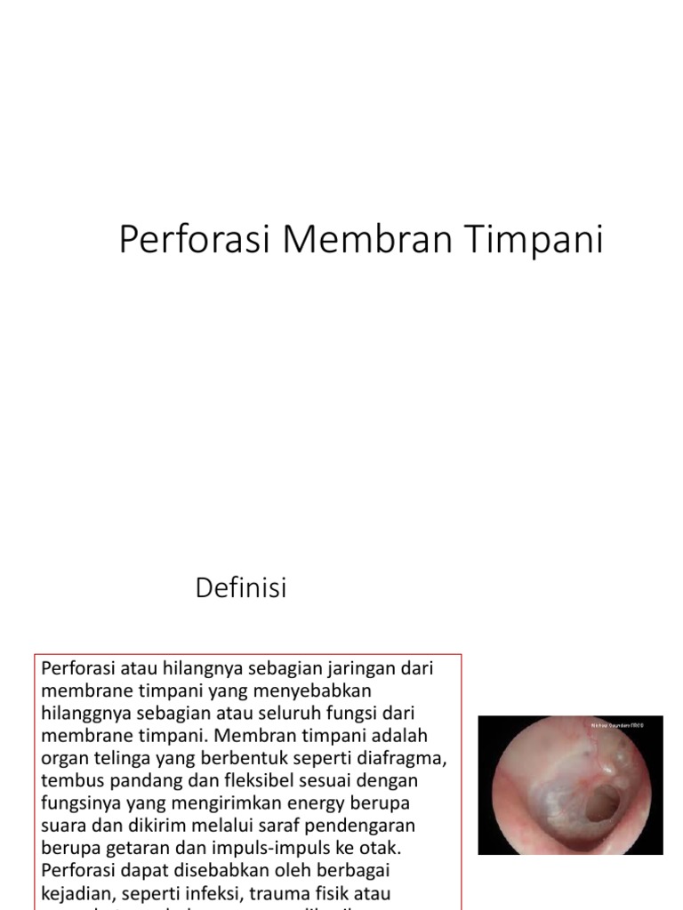 Perforasi Membran Timpani | PDF