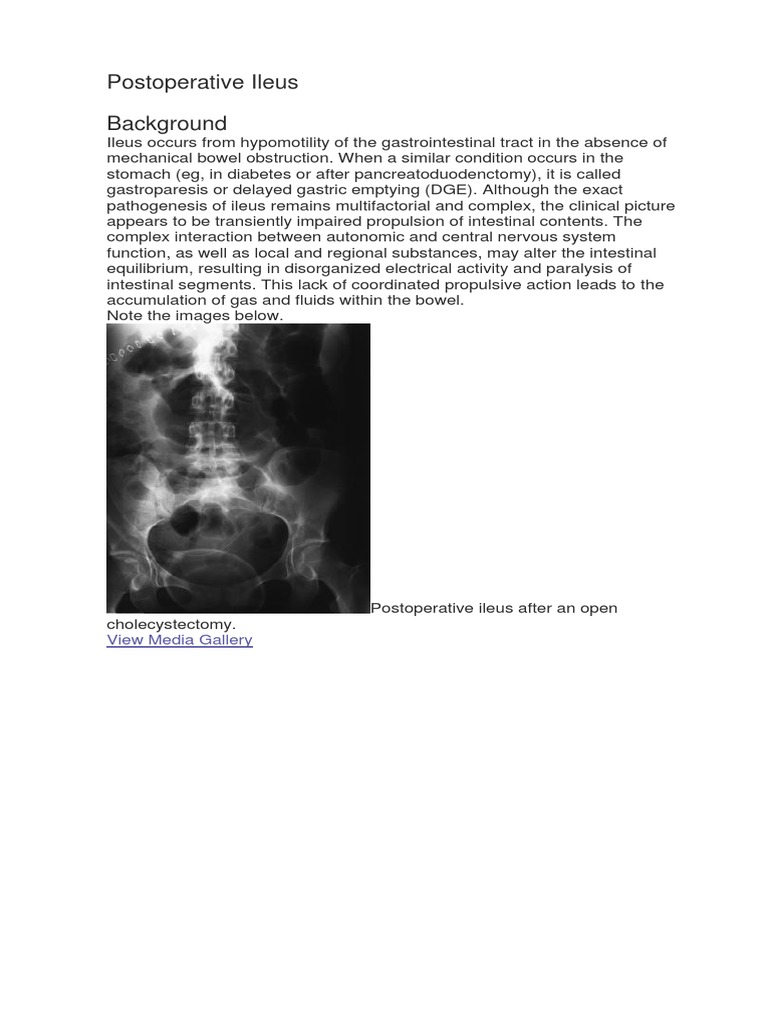 Postoperative Ileus Background: View Media Gallery | PDF ...