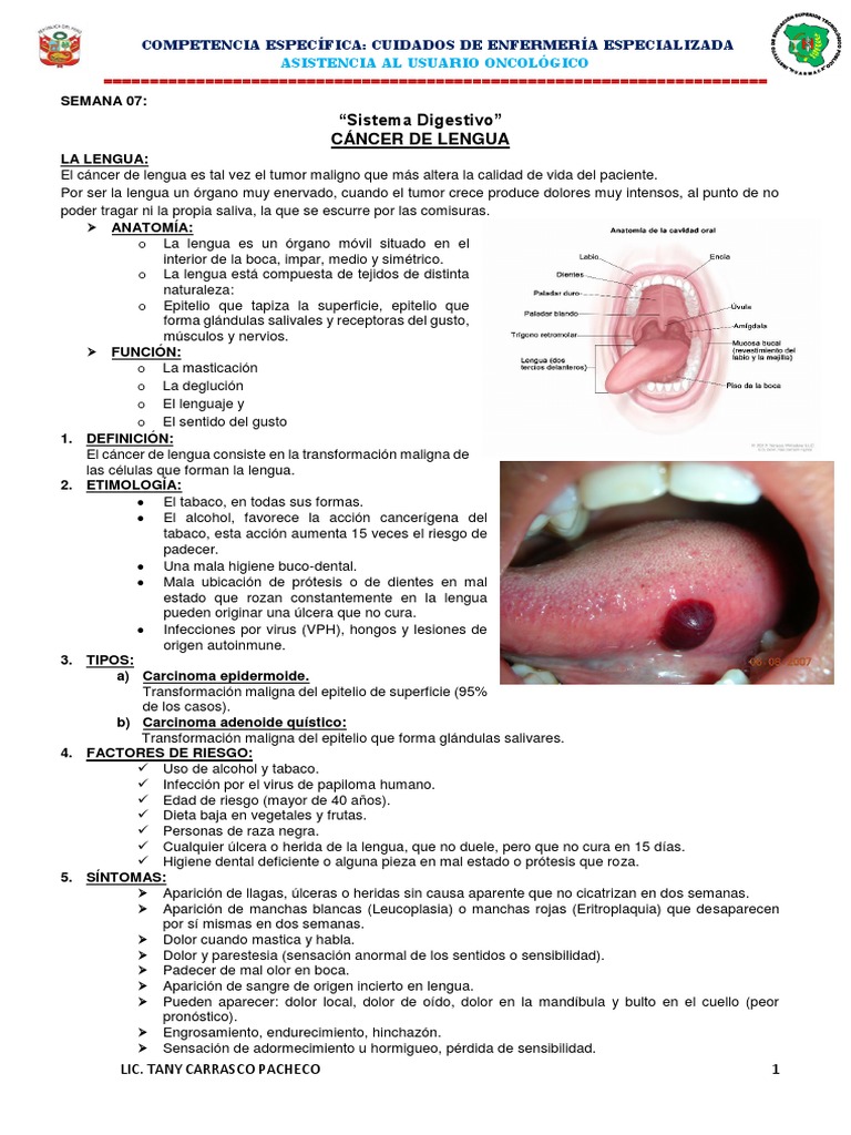 Guía de Cáncer de Lengua | PDF | Cáncer | Estómago