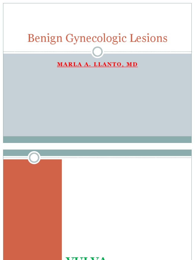 Benign Gynecologic Lesions: Urethral Caruncle, Cyst, Nevus, Hemangioma ...