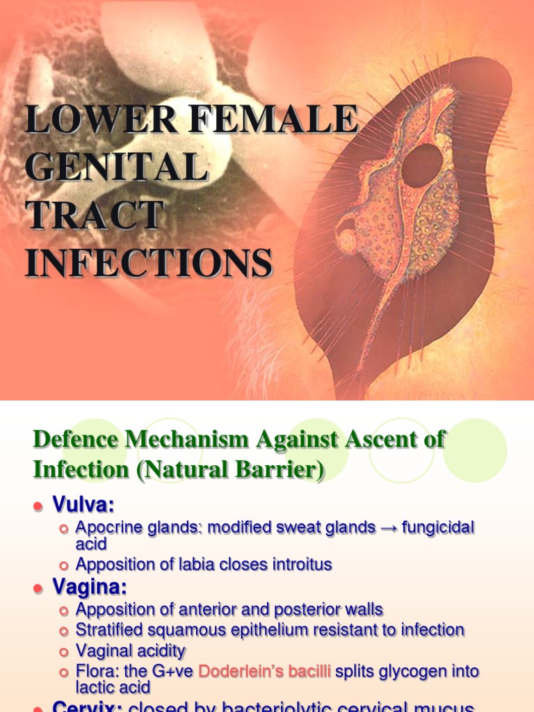 12 Lower Female Genital Tract Infections Ppt Candidiasis Vagina