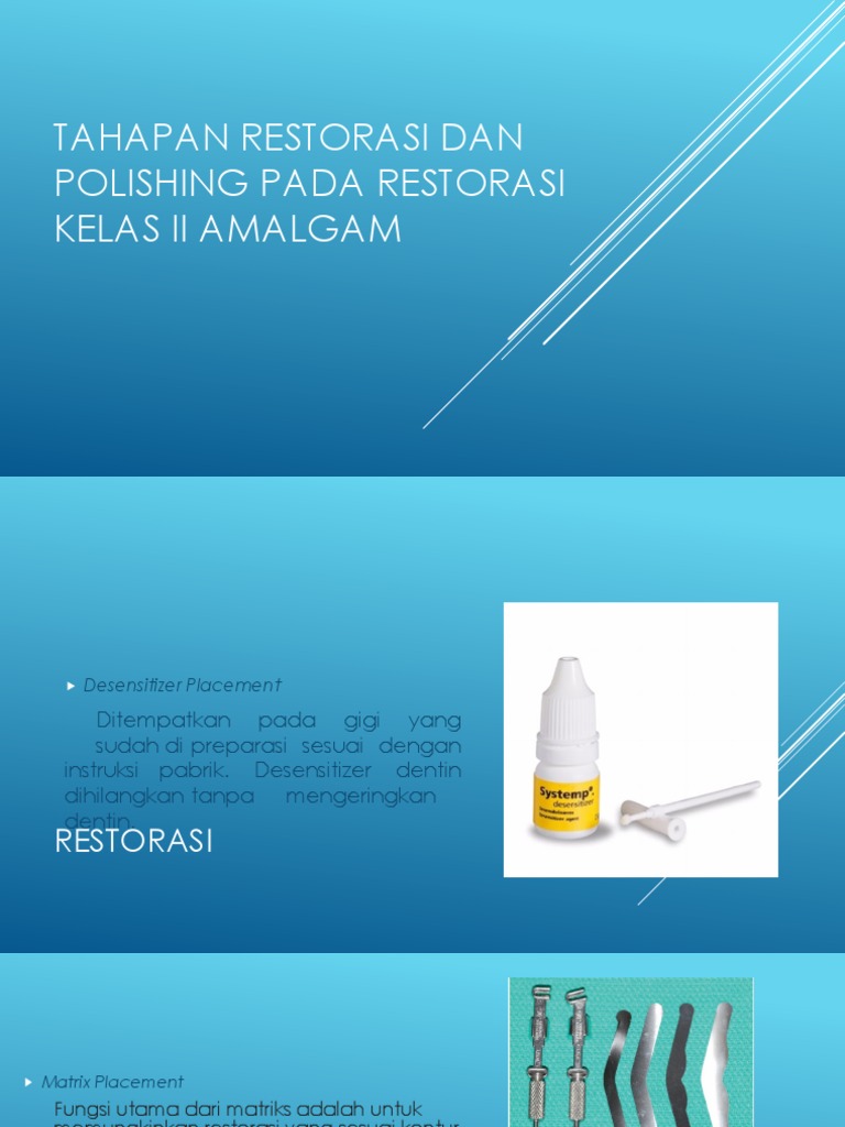 Tahapan Restorasi Dan Polishing Pada Restorasi Kelas II | PDF