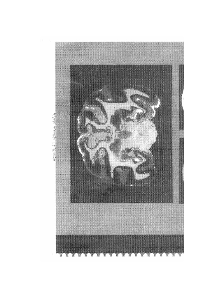 Rains Dennis - Principios de Neuropsicologia Humana (2004) PDF ...