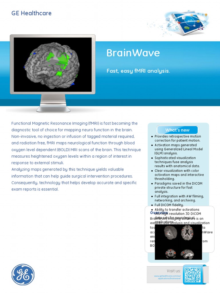 GE fMRI | PDF | Functional Magnetic Resonance Imaging | Magnetic ...
