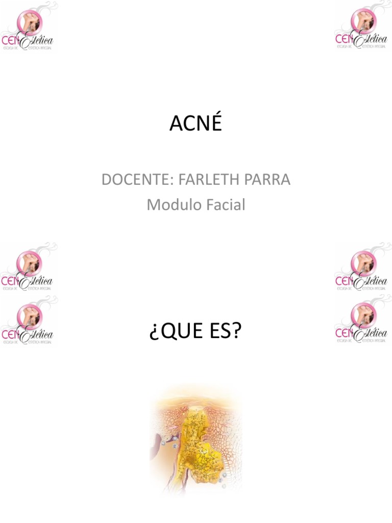 Acne Presentacion FPP | PDF | Sistema endocrino | Medicina CLINICA