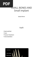 Acumed ES Surgical Technique Fibula Nail 2 ESFNA10 02 A | PDF