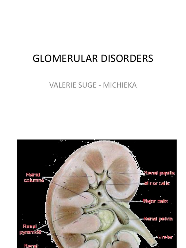 Glomerular Disorders - Glomerulonephrtis | PDF | Kidney | Animal Anatomy