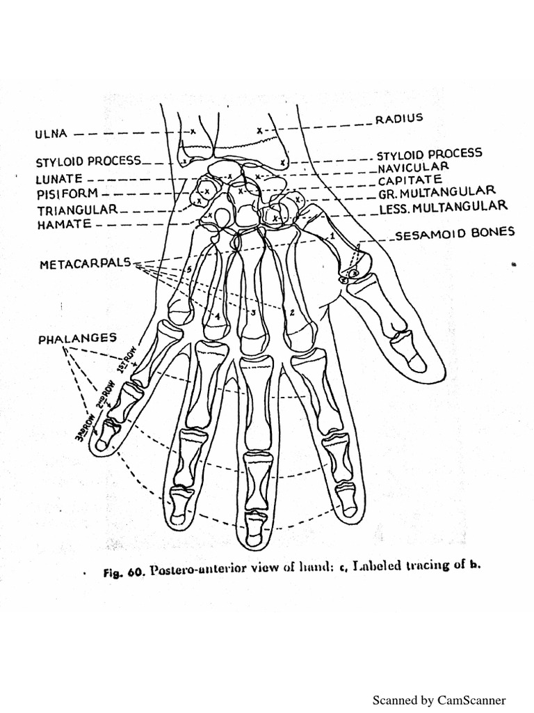Manus PA, Oblique | PDF