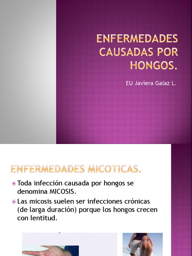 10 Enfermedades Causadas Por Hongos Y Cómo Es El Tratamiento – AAHOXN