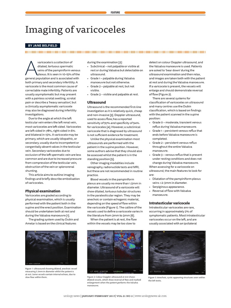 Imaging of varicoceles: key ultrasound findings | PDF | Medical ...