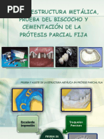 Protocolo para Prótesis Total Removible | PDF | Dentadura postiza | Boca