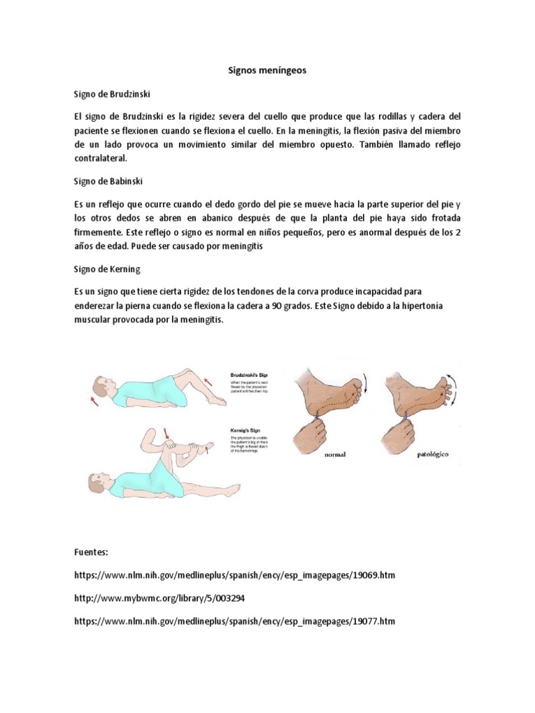 Signos Meníngeos | PDF
