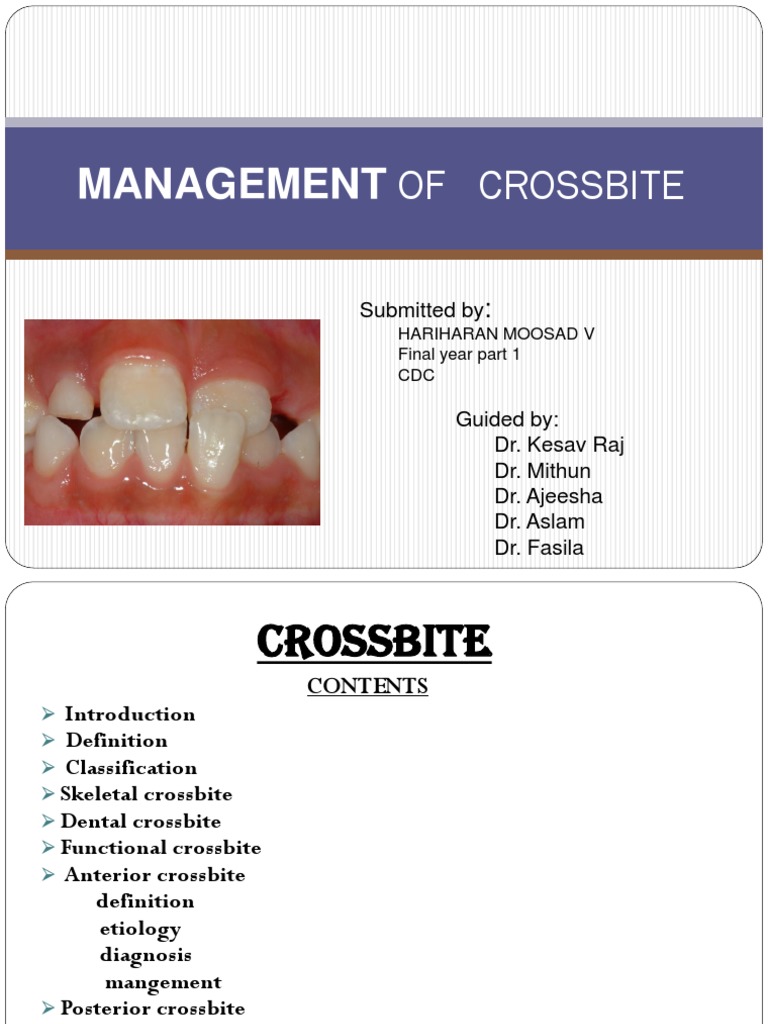 Management of Crossbite | PDF | Dental Anatomy | Human Anatomy