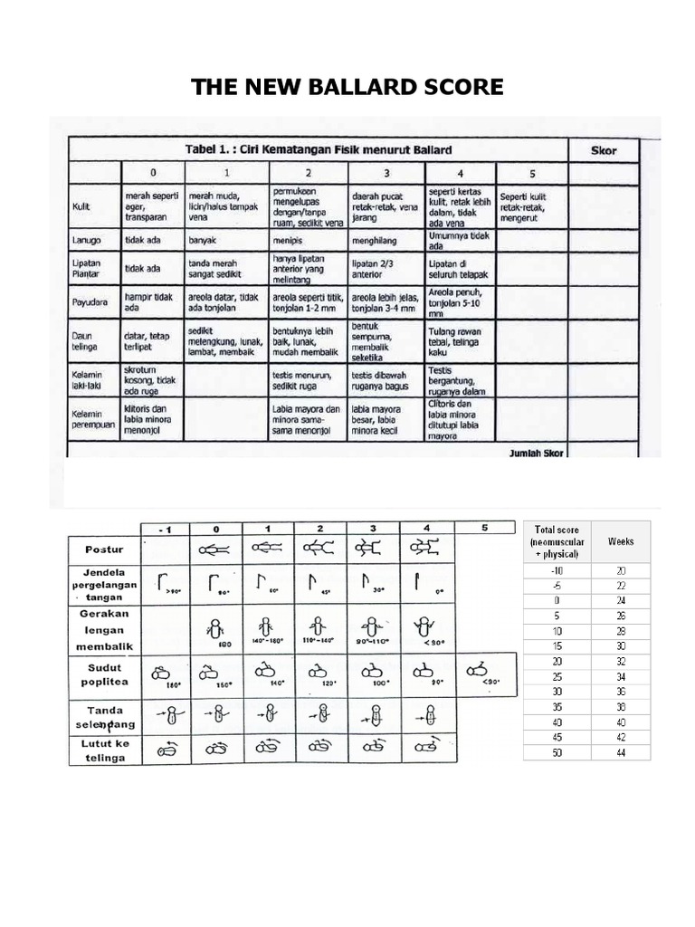 New Ballard Score | PDF