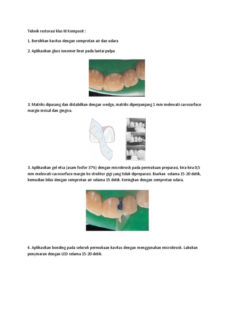 Tehnik Restorasi Klas III Komposit | PDF | Bisnis | Sains & Matematika