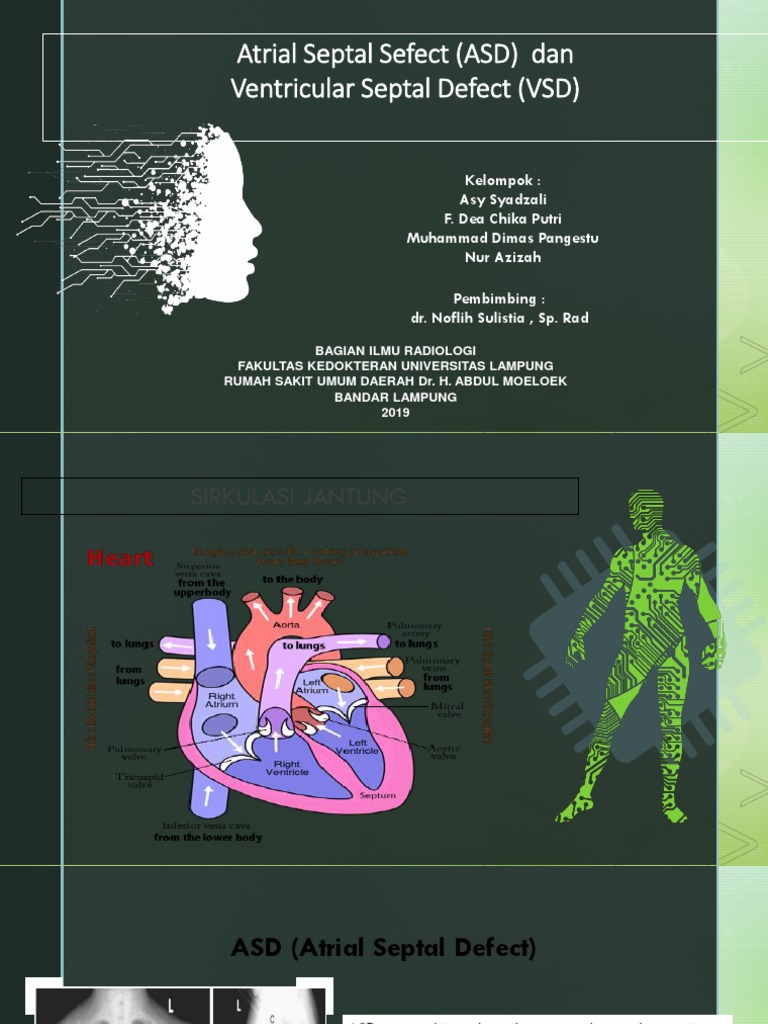 ASD and VSD: Radiological Insights | PDF | Atrium (Heart) | Ventricle ...