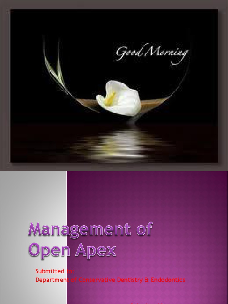 Management of Open Apex | PDF | Human Tooth | Mouth