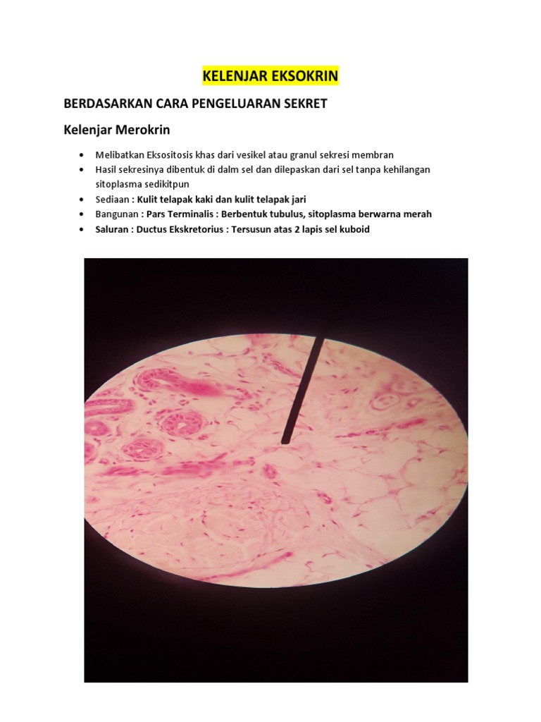 Kelenjar Eksokrin: Berdasarkan Cara Pengeluaran Sekret Kelenjar ...