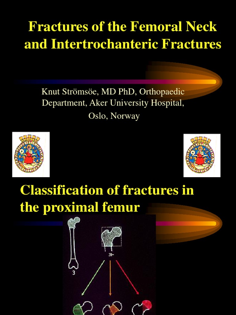 Proximal Femur Fracture Classifications | PDF | Musculoskeletal System ...