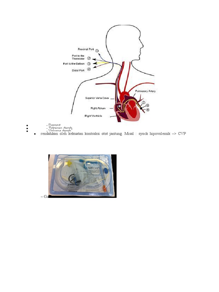 Pemasangan CVC | PDF