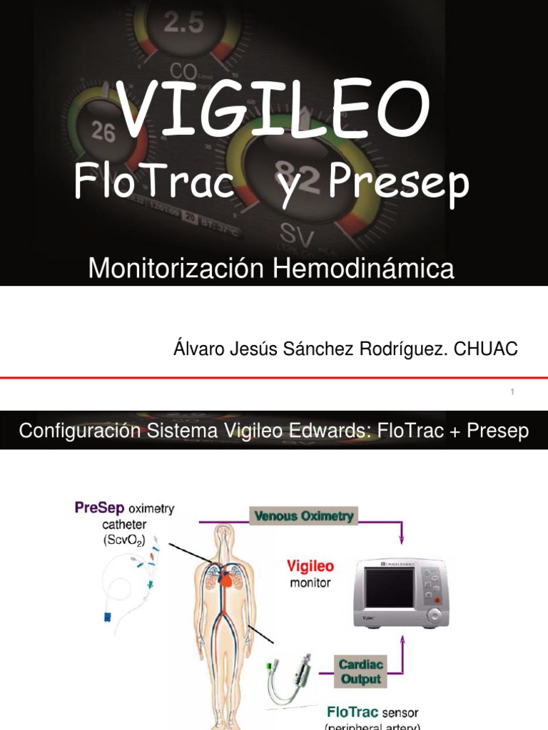 Monitorización Hemodinámica: Vigileo y FloTrac | PDF | Presión ...