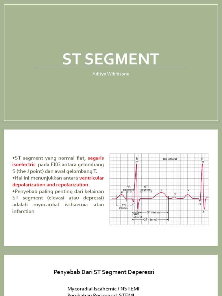 ST Segment Depressi | PDF | Electrophysiology | Electrocardiography
