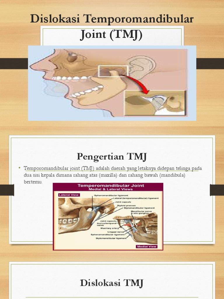 Dislokasi Temporomandibular Joint (TMJ) | PDF