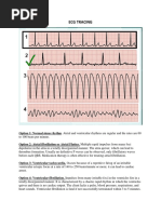 Shock Comparison Chart | PDF | Shock (Circulatory) | Heart