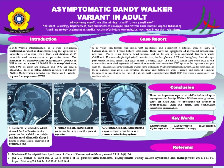 Case Report: Asymptomatic Dandy Walker Variant in Adult | PDF ...