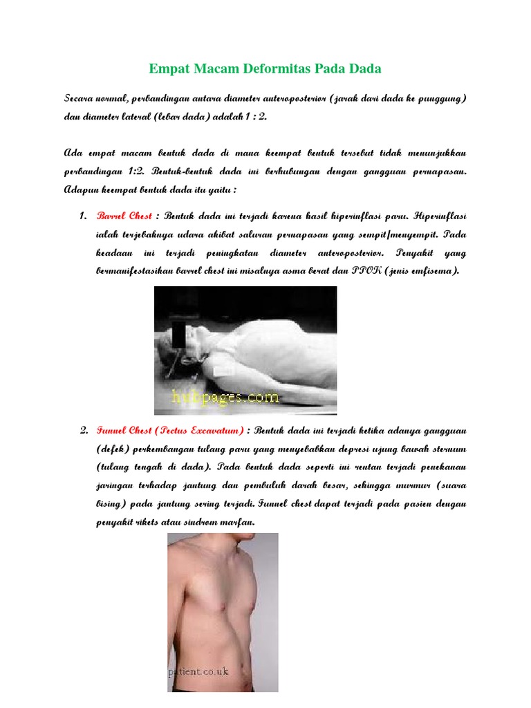 Jenis-Jenis Deformitas Dada | PDF