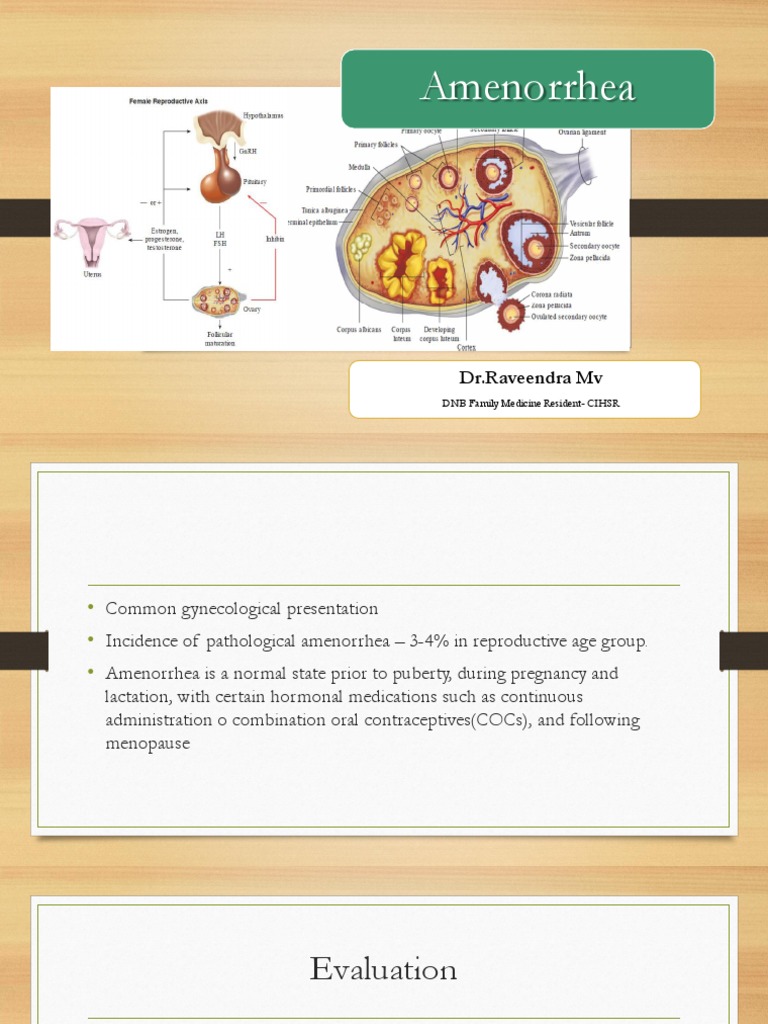 Amenorrhea: DR - Raveendra MV | PDF | Polycystic Ovary Syndrome ...