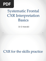 The Difference Between Chest Posterior Anterior (PA) and Anterior ...