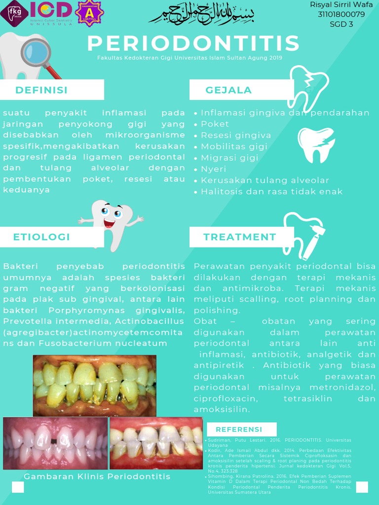 Poster Periodontitis | PDF