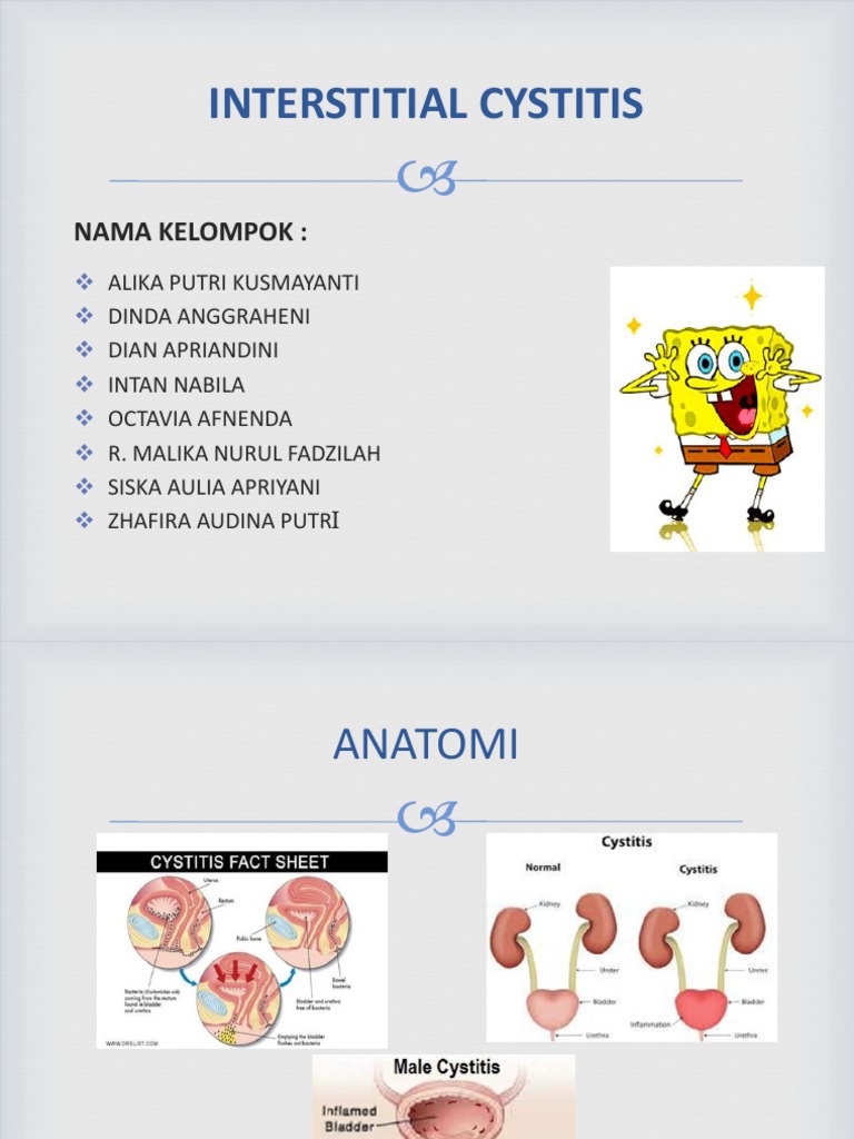 Interstitial Cystitis Ppt-1 | PDF