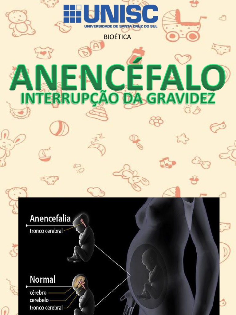 Anencefalo-Interrupção Da Gravidez | PDF | Aborto | Gravidez