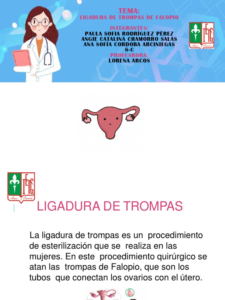 Ligadura de Trompas de Falopio | PDF | El embarazo | Enfermedades y ...