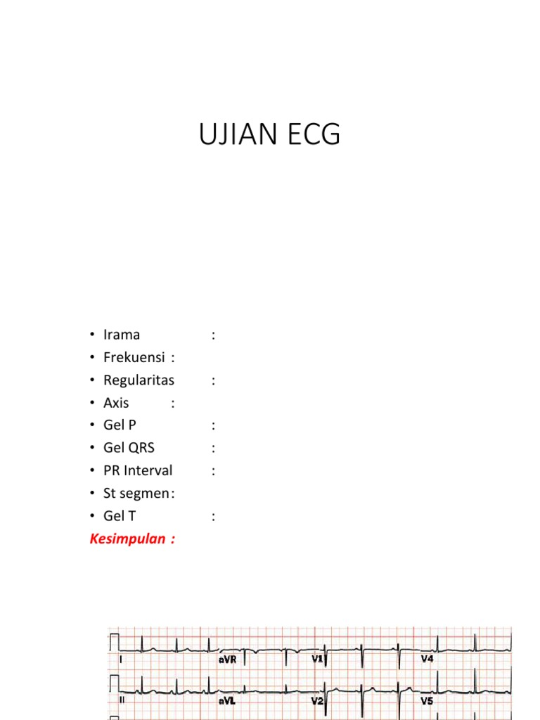Contoh Soal Ekg | PDF