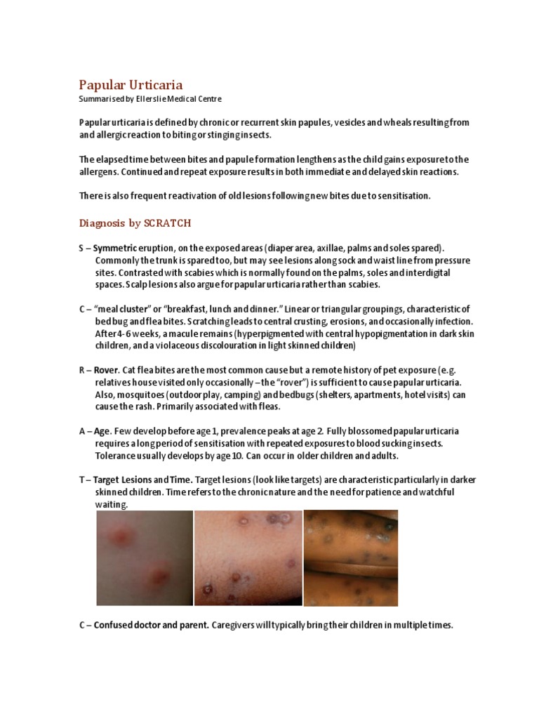 Papular Urticaria: Diagnosis by SCRATCH | PDF | Clinical Medicine ...