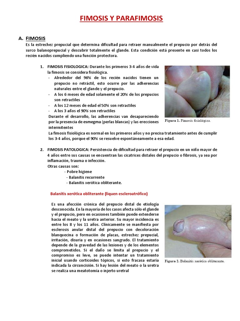 Fimosis y Parafimosis Expo Angela | PDF | Anatomia sexual | Sistema ...
