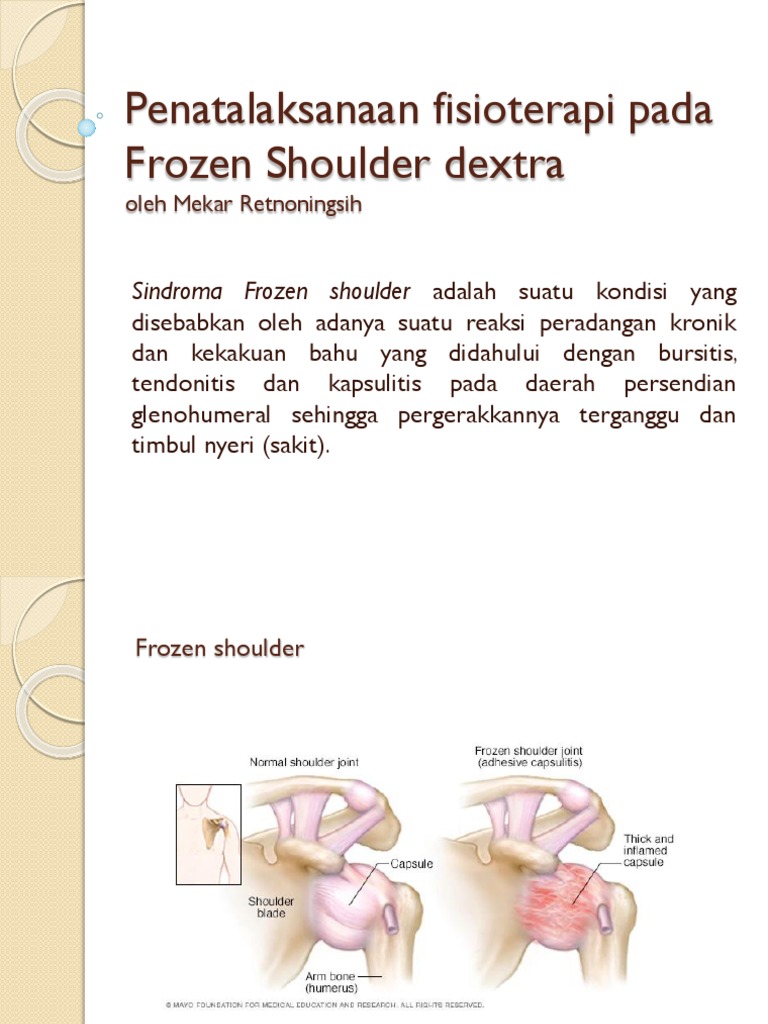 Frozen Shoulder | PDF