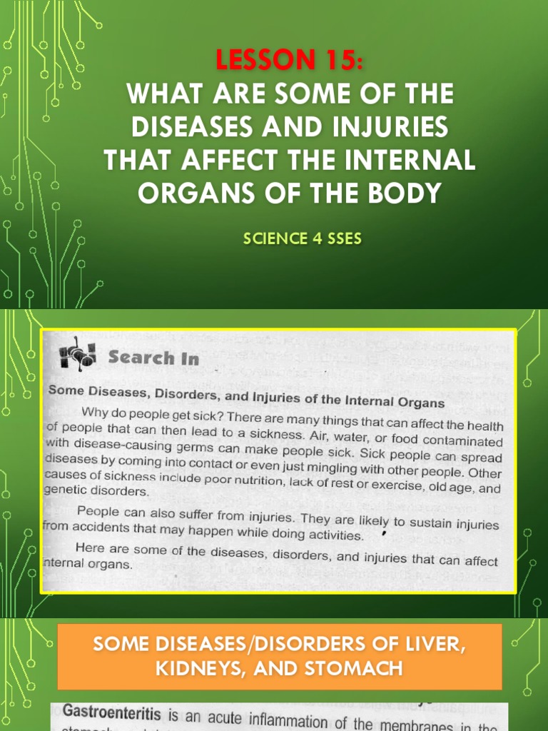 What Are Some of The Diseases and Injuries That Affect The Internal ...