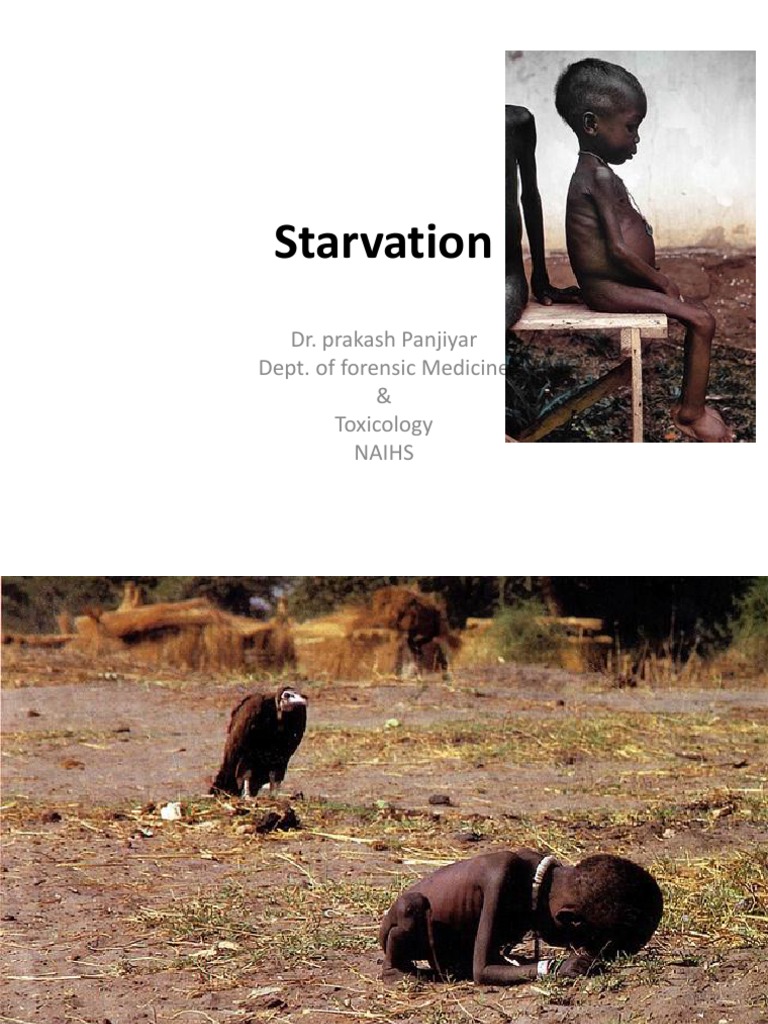 Starvation: Dr. Prakash Panjiyar Dept. of Forensic Medicine ...