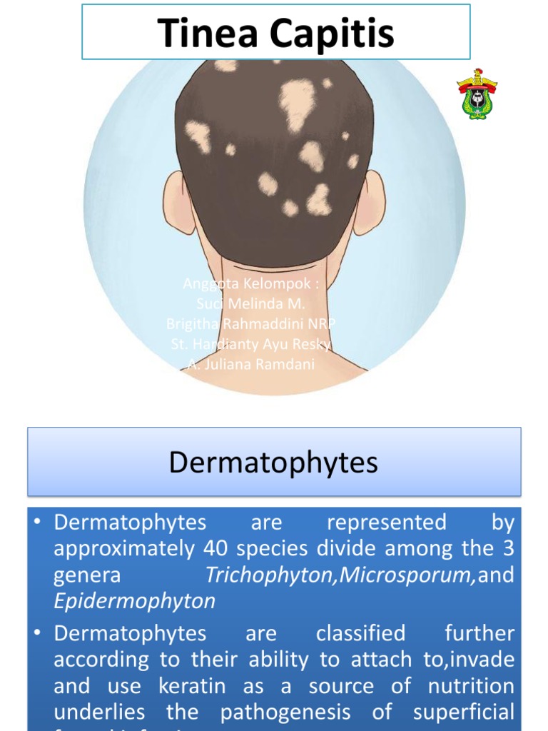 Tinea Capitis: Pathogenesis and Treatment | PDF | Diseases And ...