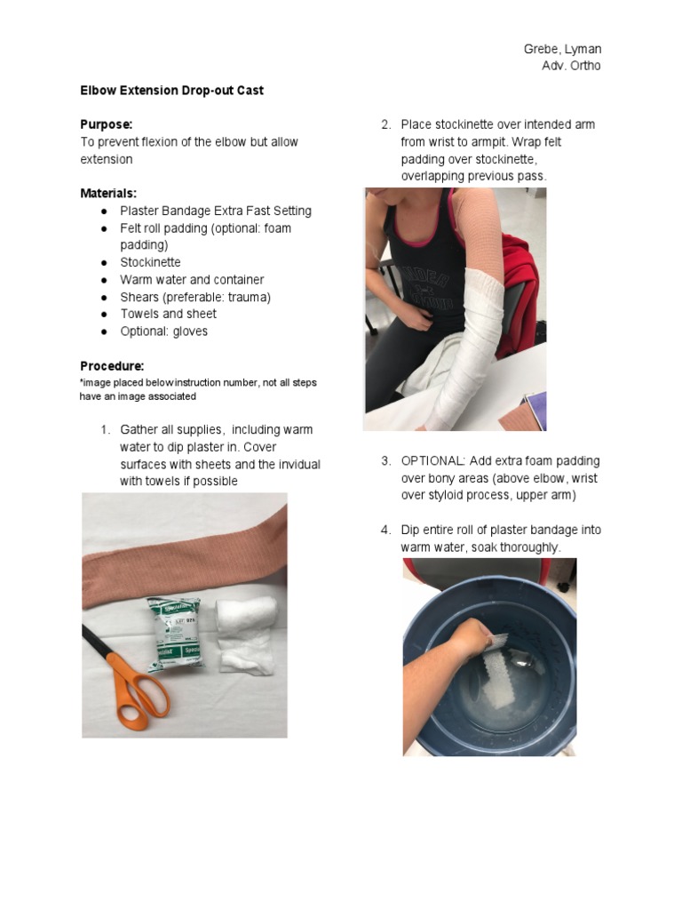 Elbow Extension Drop-Out Cast Instructions | PDF | Elbow | Anatomical ...
