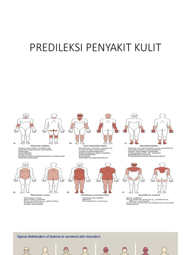 Predileksi Kulit 123 | PDF | Ilmu Sosial | Kesehatan Holistik