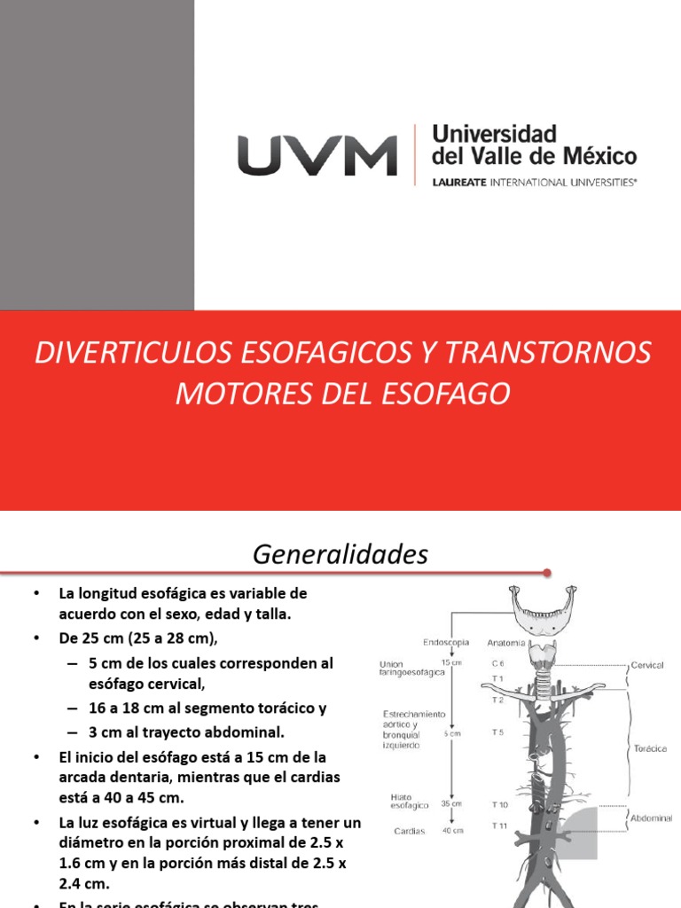 Diverticulos Esofagicos | PDF | La enfermedad por reflujo ...